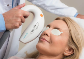 Is IPL an Effective Treatment for Dry Eye? | McFarland Eye Care